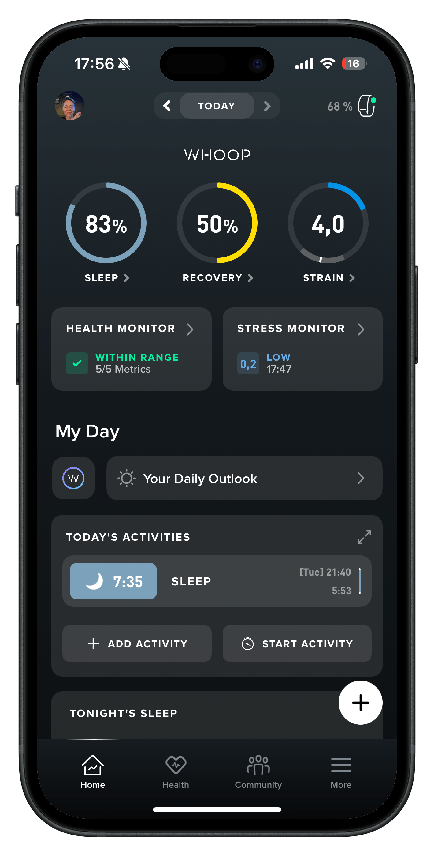 Whoop MG im Test: Das intelligenteste Wearable für Eure Gesundheit, Punkt!